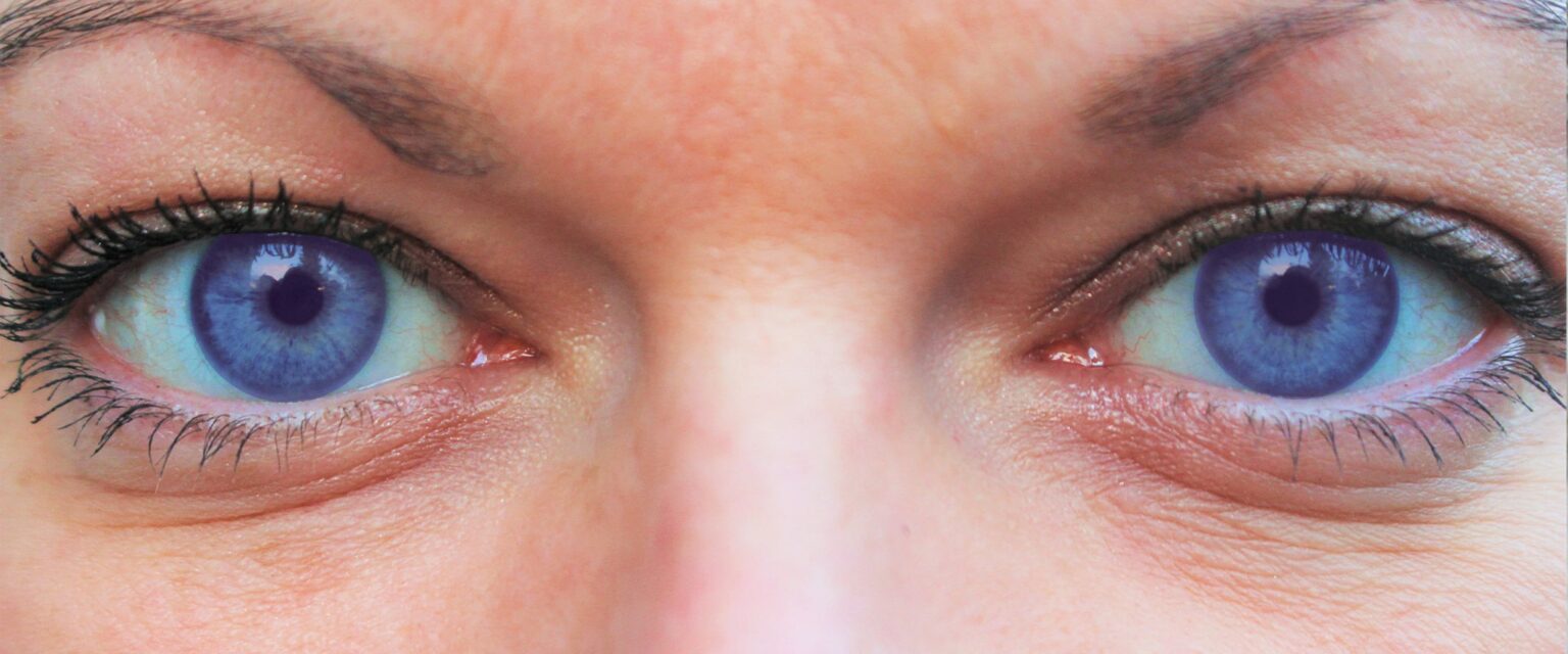Is it really possible for people to have purple eyes? - Glasses Direct Blog